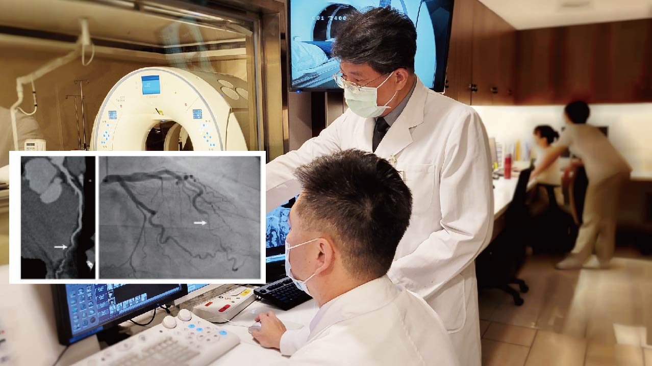 自發性冠狀動脈剝離(SCAD) — 冠狀動脈電腦斷層血管攝影檢查(CCTA)的診斷與影像特徵解析 | 永越健康管理中心